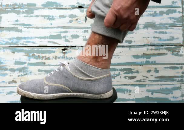 Bad leg and Illness of human skin. Scratch scars, ulcers and age spots ...