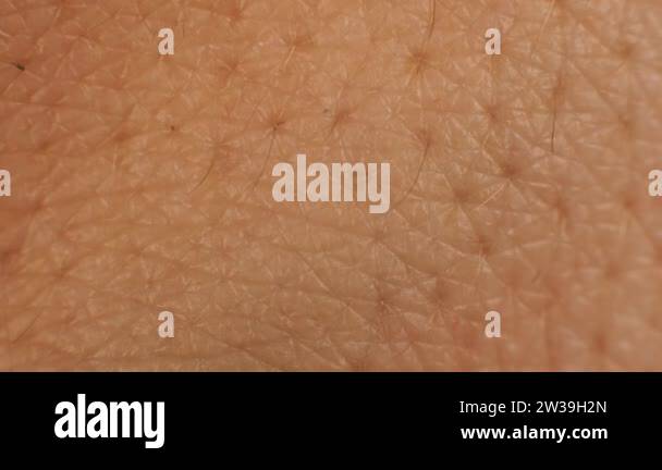 Human skin texture, close-up. Dry skin care concept. Moisturizing and ...