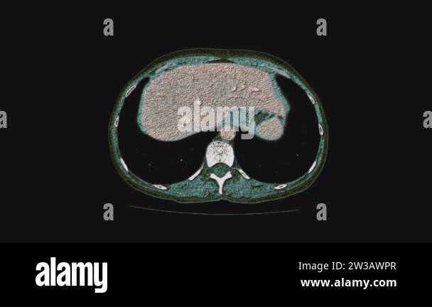 Bulk multicolored MRI of the female pelvic organs, abdominal cavity ...