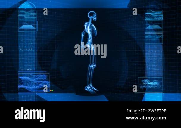 Ray scan human skeleton hd Stock Videos & Footage - HD and 4K Video ...