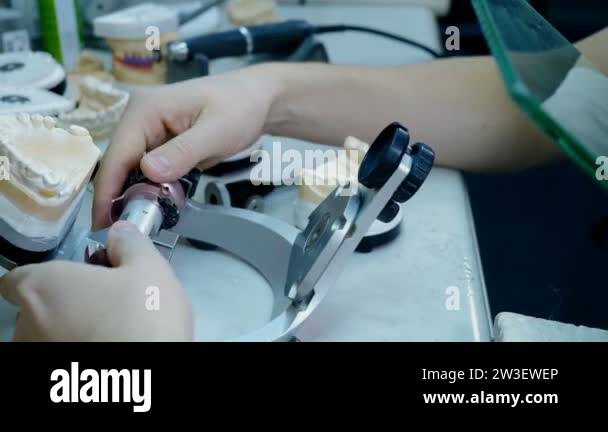 Dental prosthesis, artificial tooth, prosthetic. Male hands setting ...