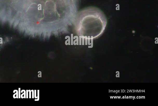 The rotifers commonly called wheel animals or wheel animalcules, make ...