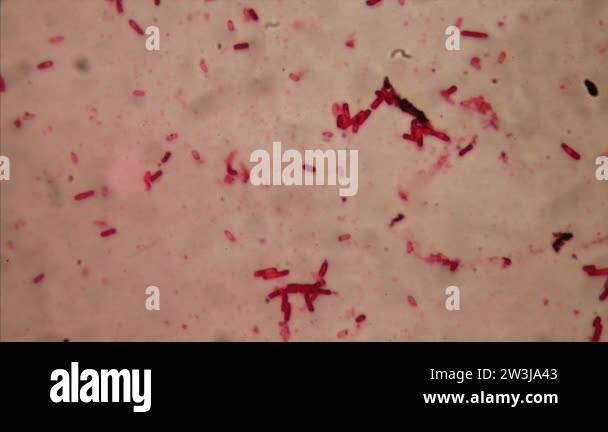 frame, microbes under a microscope Stock Video Footage - Alamy