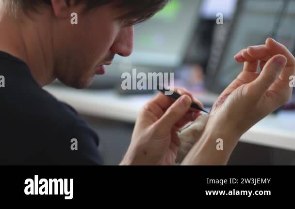 Man cleaning a bleeding wound under the skin after the accident ...