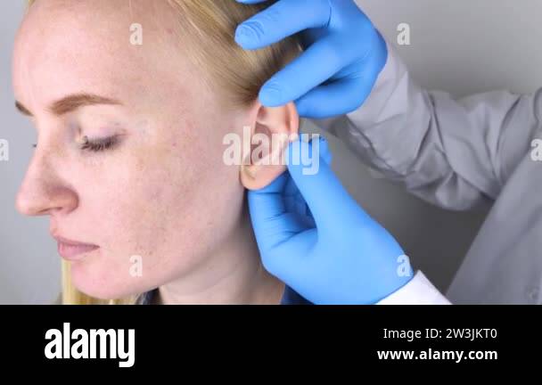 A plastic surgeon examines a patient's auricle. The doctor sees a ...