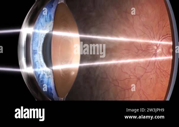 Eye anatomy - inner structure, Medically accurate Stock Video Footage ...