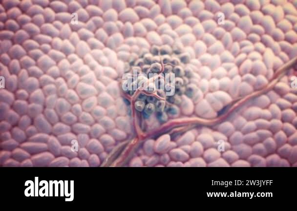 Cancer Cell Division. Tumor Growth and Progression. Abnormal and ...