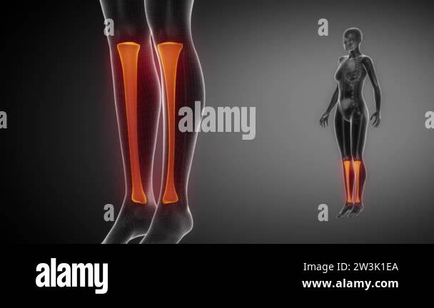 TIBIA bone skeleton x-ray scan Stock Video Footage - Alamy