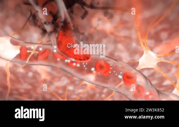 Brain vascular system blood Stock Videos & Footage - HD and 4K Video ...