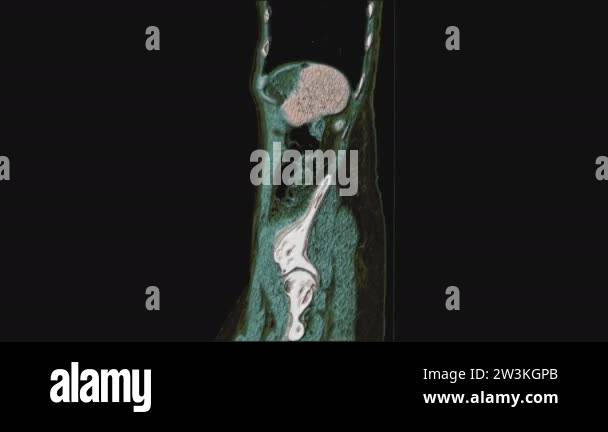 Bulk multicolored MRI of the female pelvic organs, abdominal cavity ...