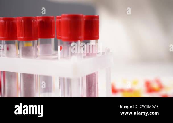 Stand with blood sample test tubes in research medical laboratory. Test ...