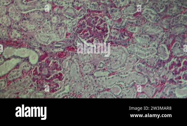 Kidney histology Stock Videos & Footage - HD and 4K Video Clips - Alamy