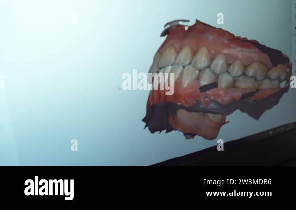 Dental consultation, diagnostics. Jaw scanning, digital imprint ...