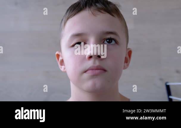 Boy with Drooping Upper of Eyelid, Long Lashes. Myopia. Pupil Rotation ...