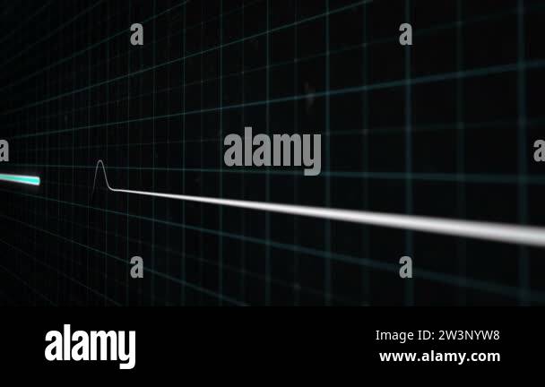 Flatline ecg Stock Videos & Footage - HD and 4K Video Clips - Alamy