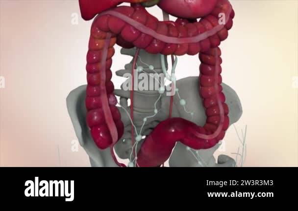 Bowel biopsy Stock Videos & Footage - HD and 4K Video Clips - Alamy