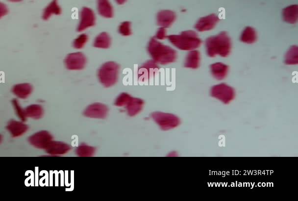 Stained cells of the oral mucosa with cell nuclei and bacteria under ...