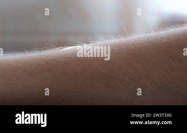 Goose flesh texture Stock Videos & Footage - HD and 4K Video Clips - Alamy