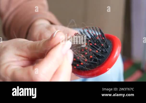 Female hands clean Drop down hair on a comb after combing. Lots of ... Female hands clean Drop down hair on a comb after combing. Lots of ...