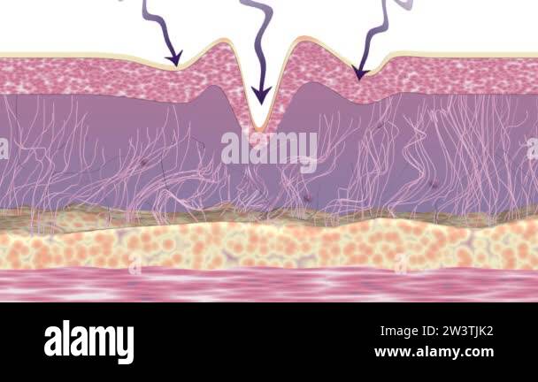 Wrinkle reduction and collagen regeneration. Skin rejuvenation ...