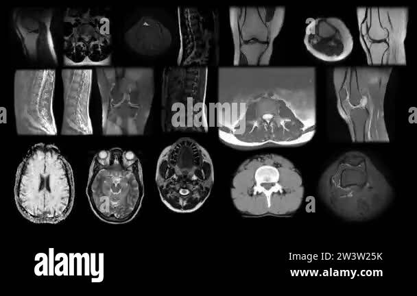 Human skeleton radiography medical scan Stock Videos & Footage - HD and ...
