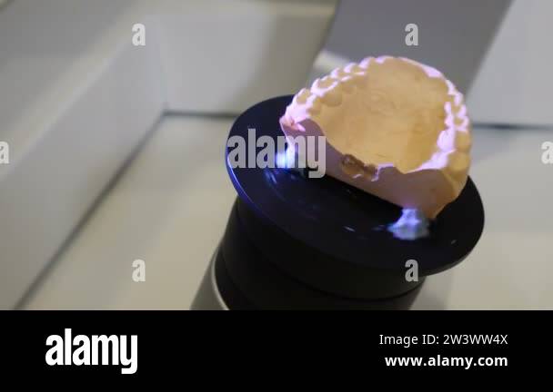 3d tooth scanning in modern dentistry. Dental prosthetic restoration ...