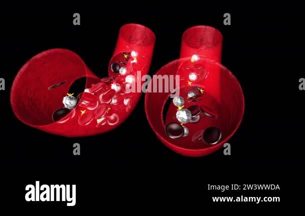 3d animation of veins with anemic blood and normal blood and more matte ...
