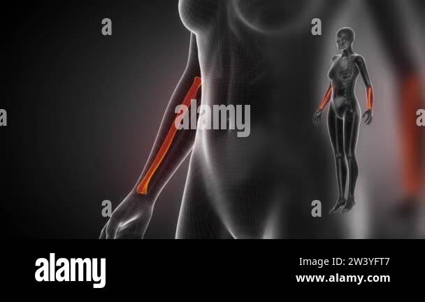RADIUS bone skeleton x-ray scan Stock Video Footage - Alamy