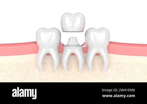 Crown fill Stock Videos & Footage - HD and 4K Video Clips - Alamy