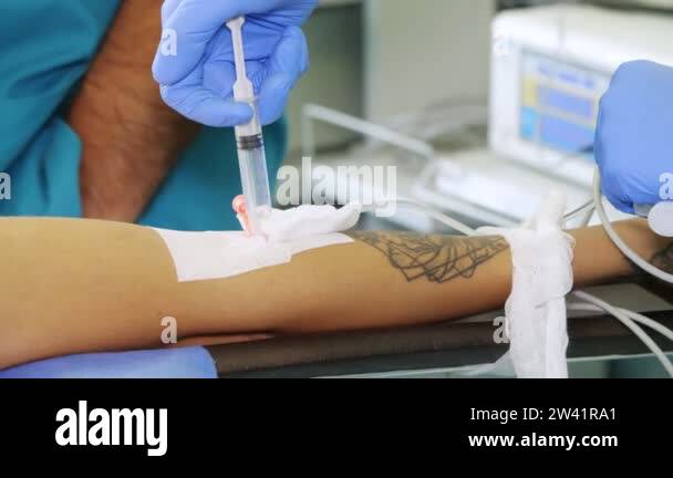 close-up, peripheral venous catheter is installed on patients arm ...