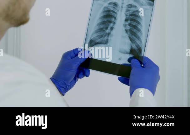 X-ray of the lungs in the doctor's hands,to study a person's illness ...