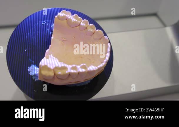 3d jaw scanning in modern dentistry. Dental prosthetic restoration ...