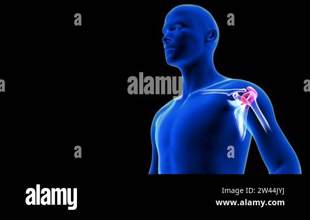 Shoulder Pain close-up animation. Blue Human Anatomy Body 3D Scan ...