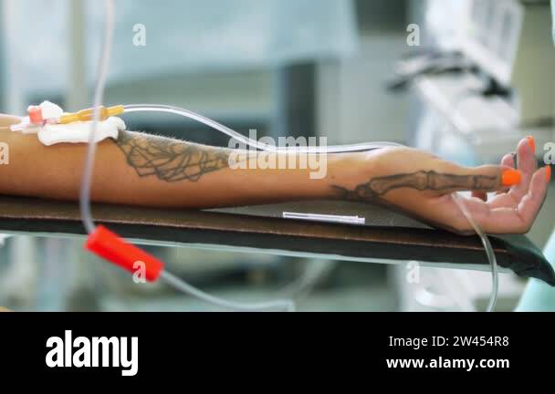 close-up, a peripheral venous catheter is installed on the patients arm ...