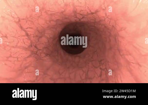 Endoscopy colon Stock Videos & Footage - HD and 4K Video Clips - Alamy