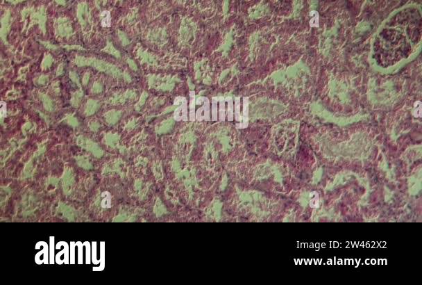 Pig kidney anatomy Stock Videos & Footage - HD and 4K Video Clips - Alamy