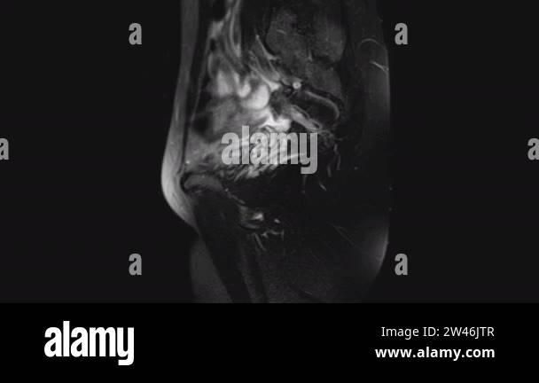 MRI of the female pelvic organs, abdominal cavity, gastrointestinal ...