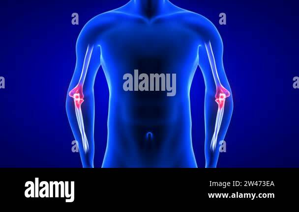 Elbow Pain animation front view close-up. Blue Human Anatomy Body 3D ...