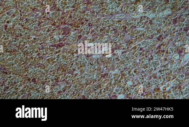 Pituitary gland in cross section under the microscope 100x Stock Video ...