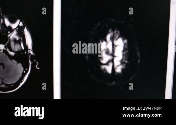 Mri images of brain Stock Videos & Footage - HD and 4K Video Clips - Alamy