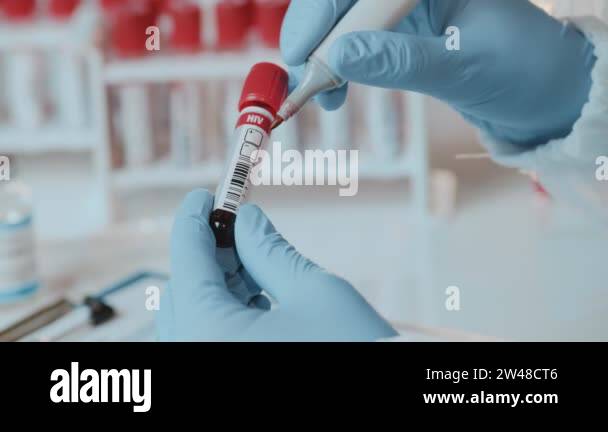 Hiv blood test form Stock Videos & Footage - HD and 4K Video Clips - Alamy