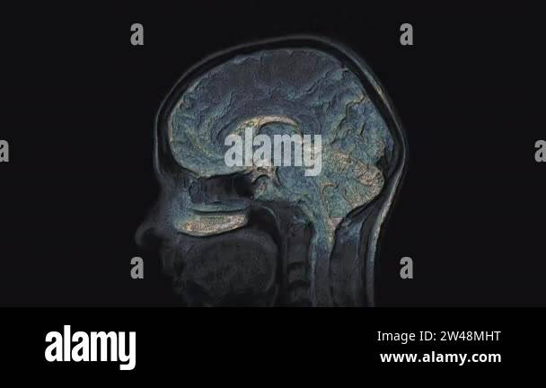 Bulk multicolored MRI brain, head scans and tumor detection. Diagnostic ...
