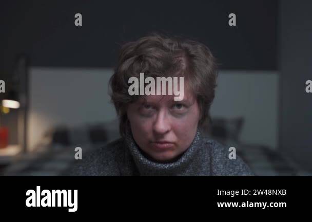 Young woman with injuries and trauma on face from domestic physical ...