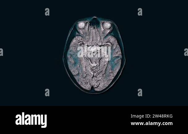 Voluminous color MRI brain, head scans and tumor detection. Diagnostic ...