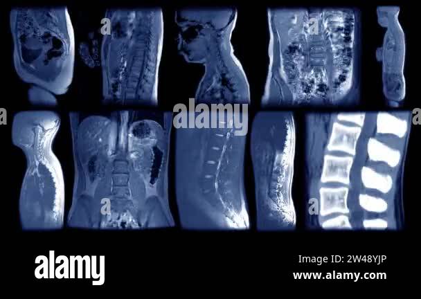 MRI scans set multi screen, human brain, head, body, bones, spine and ...