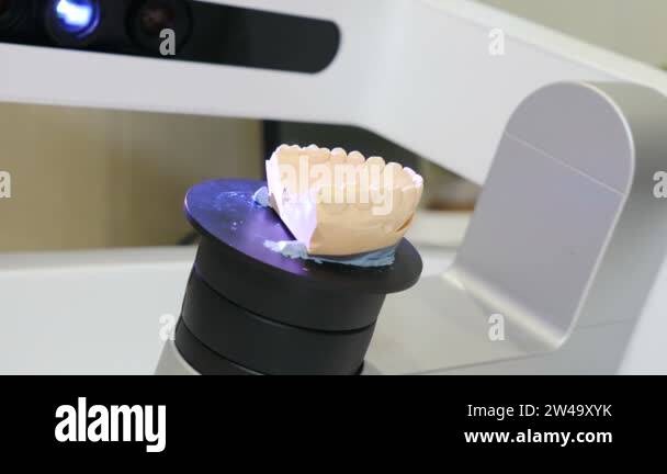 3d jaw scanning in modern dentistry. Dental prosthetic restoration ...