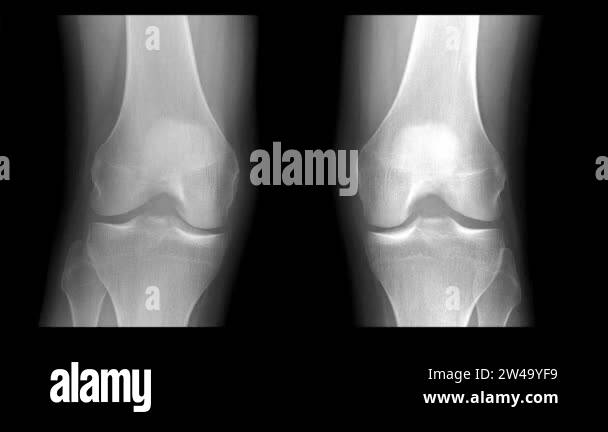 Stop motion of body parts ct or x-ray scan collection. Human hands ...