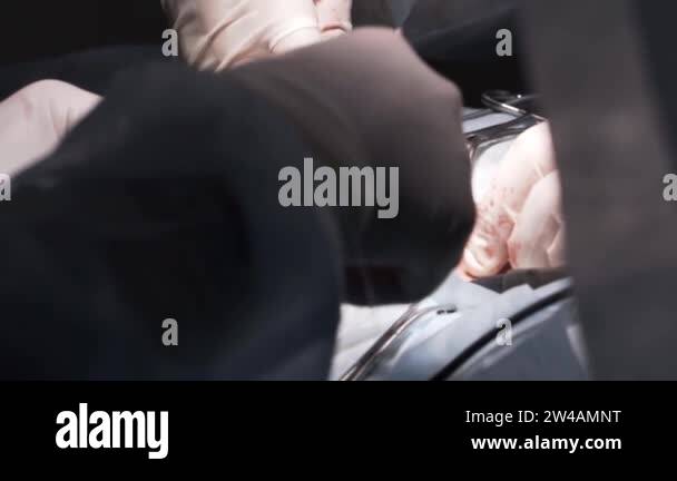 Close up of professional surgeons sewing up an open wound during ...