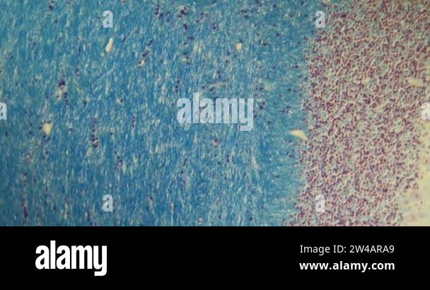 Central nervous system CNS of the rat in cross section under the ...