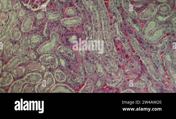 Kidney of the hedgehog in cross section under the microscope 100x Stock ...